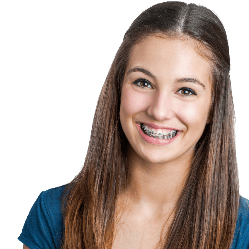 Palate Expanders for Pediatric Orthodontic Patients | Alpharetta, GA